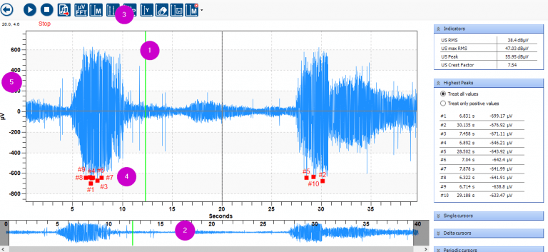 UAS3 - SDT Ultrasound