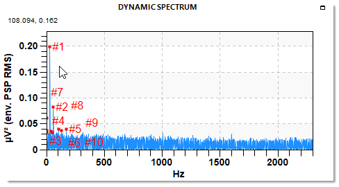 UAS3 - SDT Ultrasound