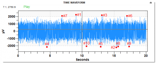 UAS3 - SDT Ultrasound